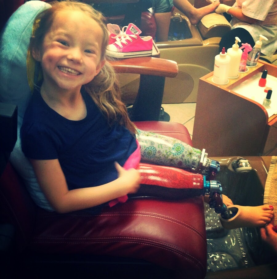 A 6 year old girls journey of becoming a double amputee