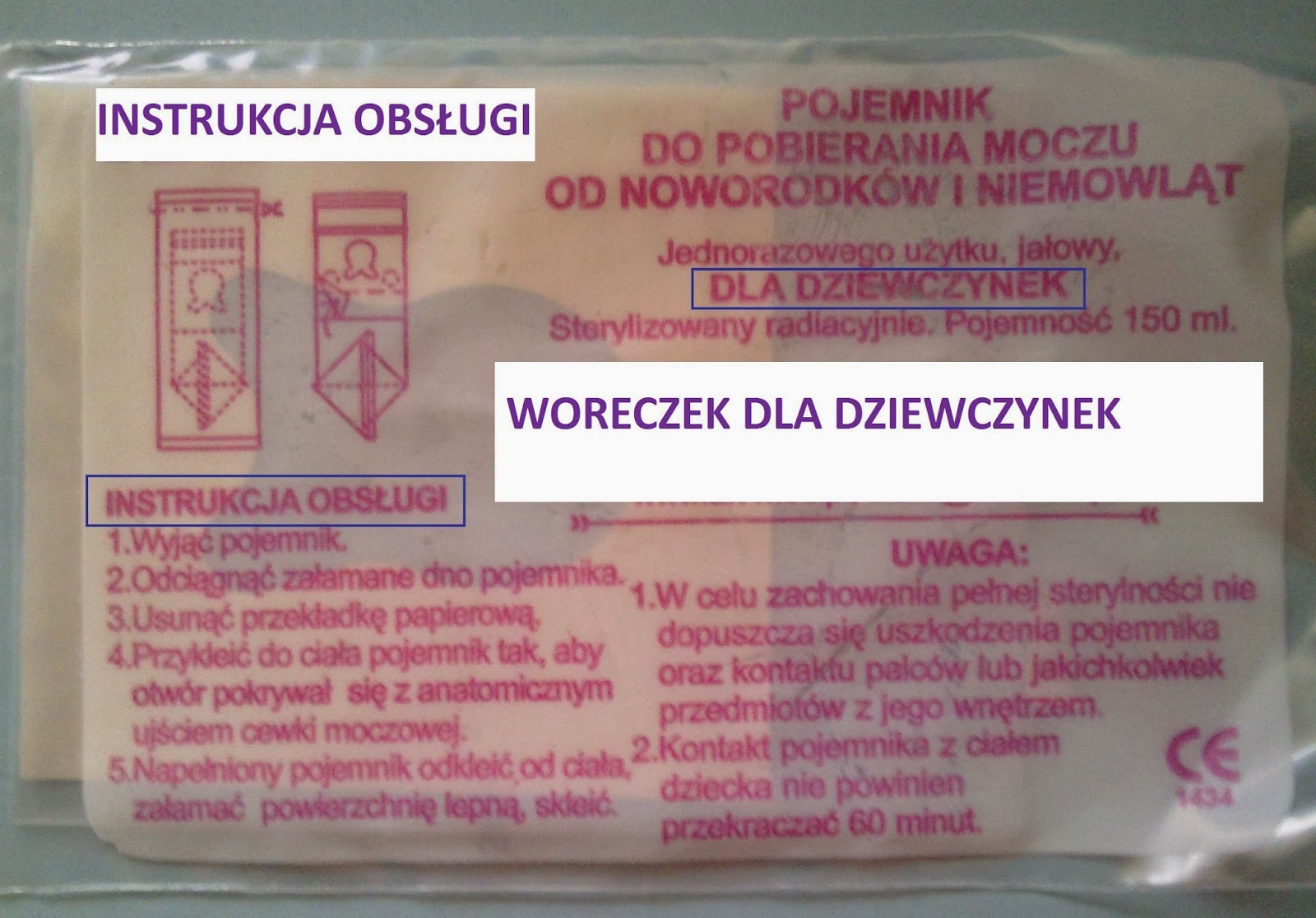 Bez skrępowania o diagnostyce i badaniach: Jak pobrać mocz u noworodka ...