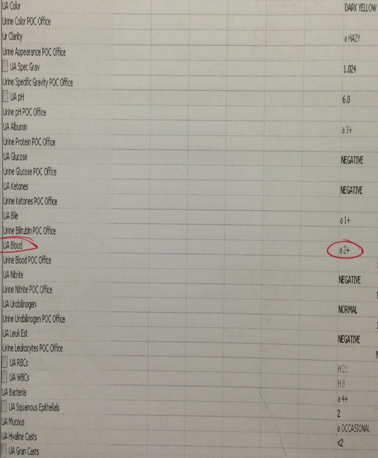 Diagnosis: Ttp Diagnosis