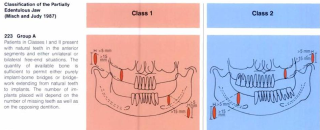 TRATAMIENTOS DENTALES: marzo 2013