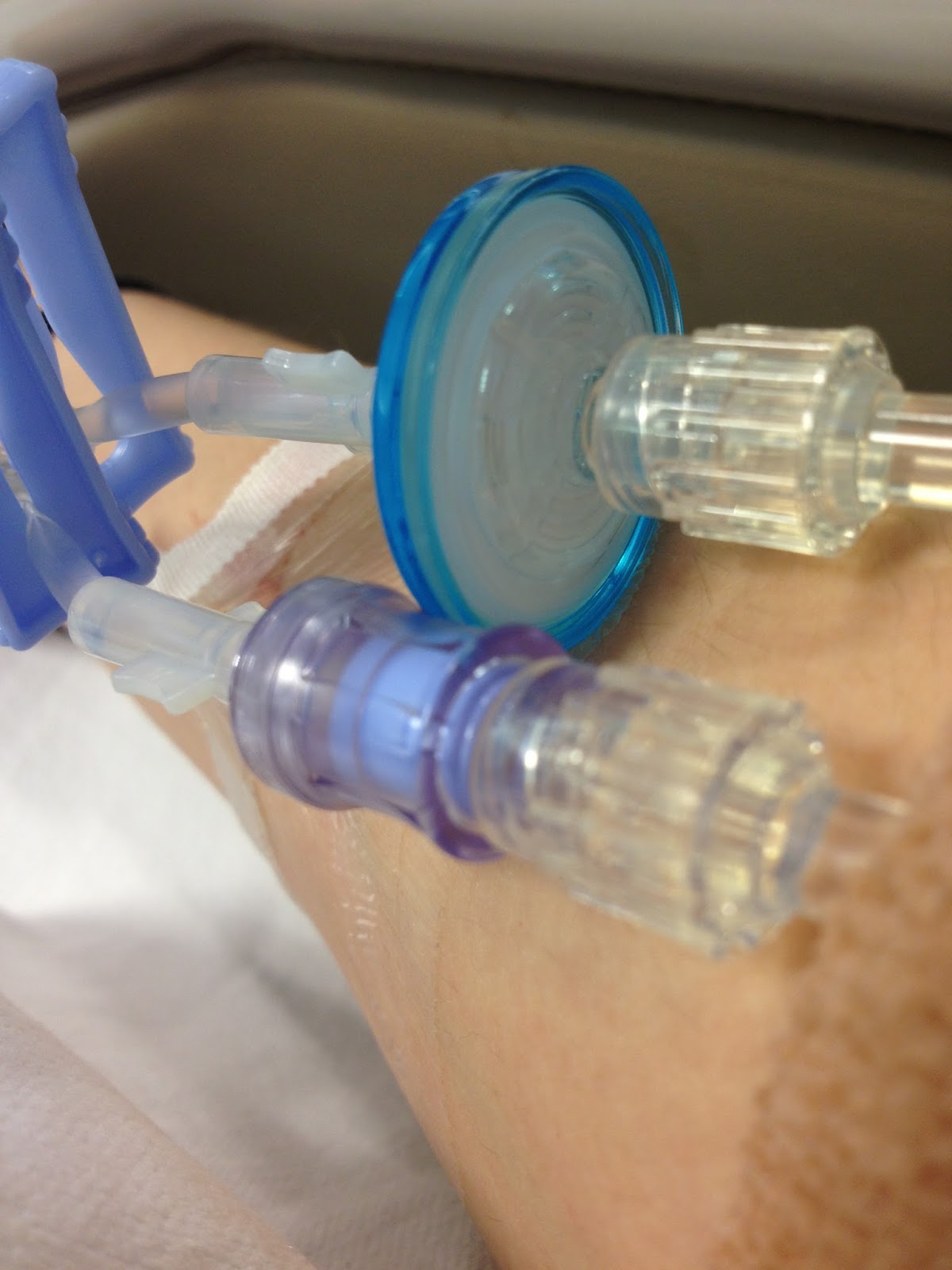 The Complicated Colon: Remicade: The Infusion Experience