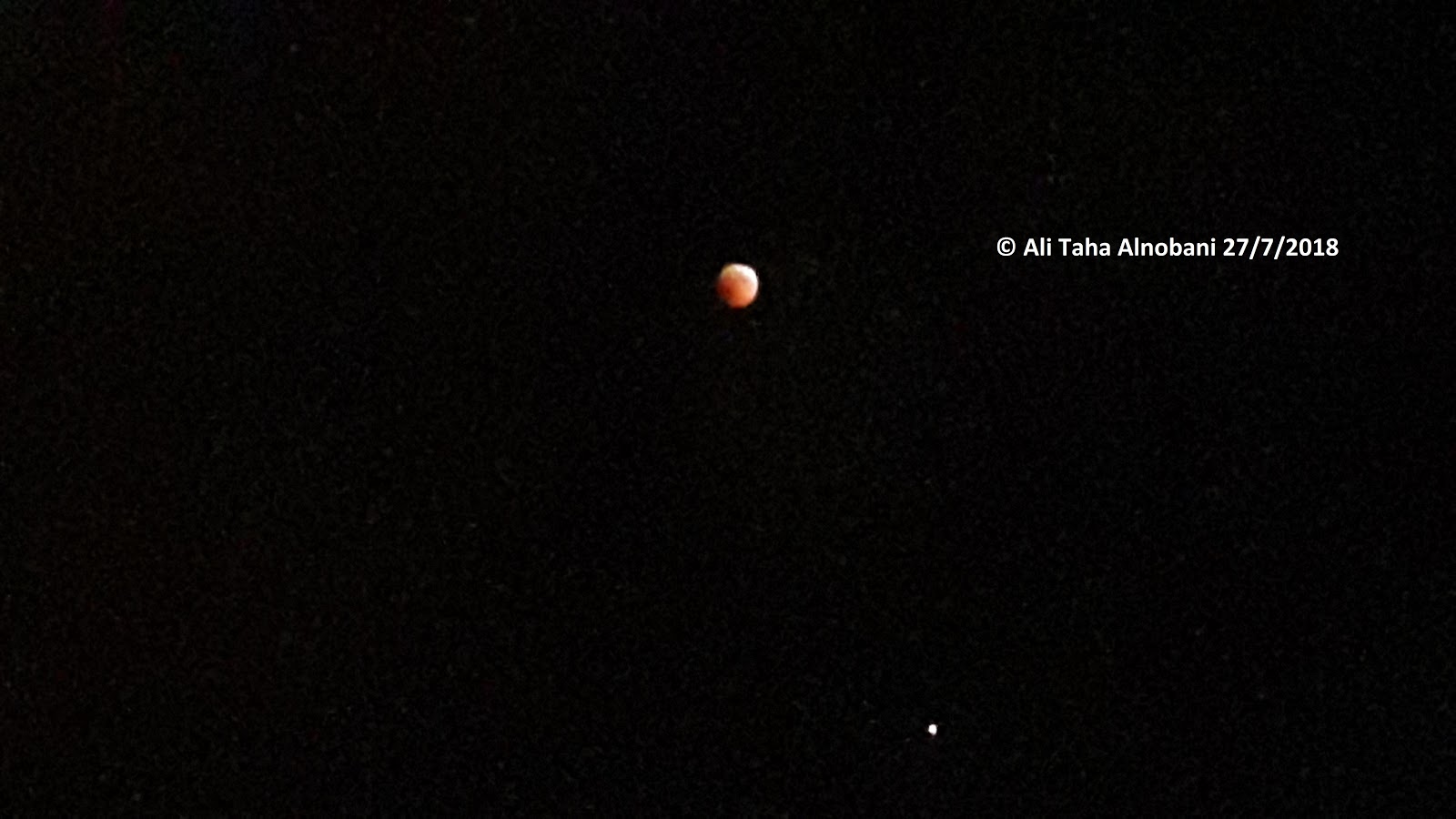 How To Get Rid of Gynecomastia With Exercise