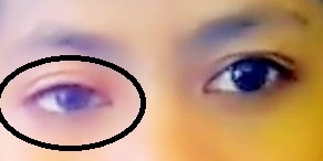 NasuhaMohamed: MATA SEPET SEBELAH.