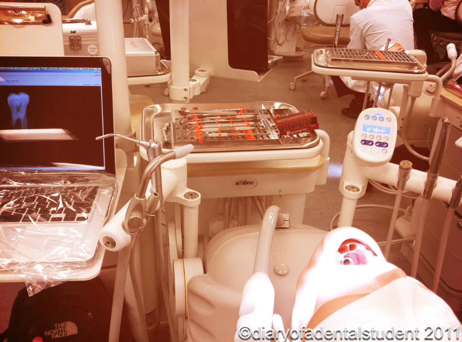 diary of a dental student: Root Canal Therapy Monday