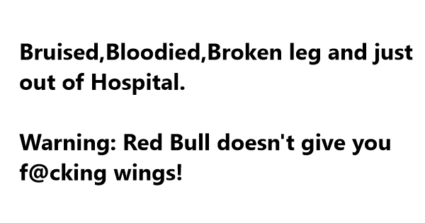 Broken Leg Hilarious Jokes,Quotes,One Liners,Pictures And Lot More To Laugh