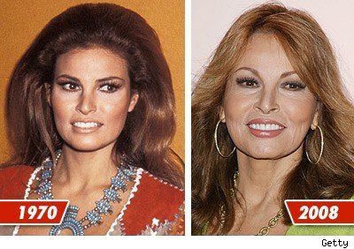 Raquel Welch Plastic Surgery