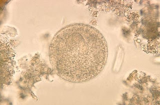 kelas A2 AAK nasional surakarta: Balantidium coli