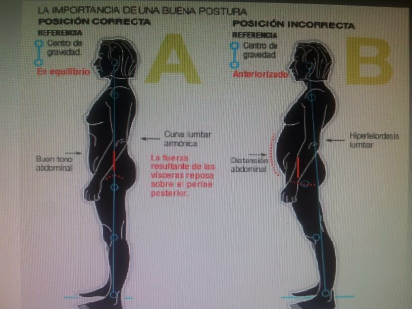 Anfis Fisioterapia: CAMBIOS EN LA COLUMNA DURANTE EL EMBARAZO