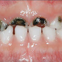 PATOLOGÍAS ODONTOLÓGICAS