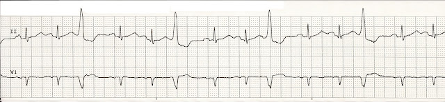 EKG Rhythm Strip Quiz 19