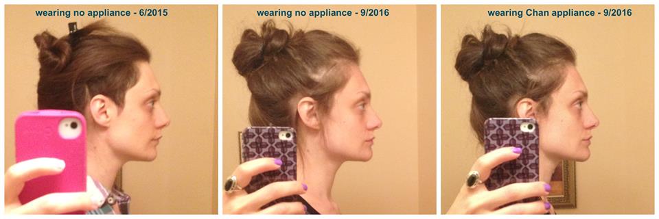 MessiahMews Blogs: HEALING TESTIMONIAL - Valerie Blanchett Update ...