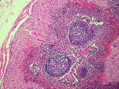 El Cuerpo Humano: La linfa