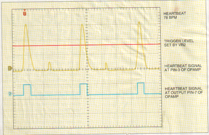 Engineer S Choice Microcontroller Based Heart Rate Meter