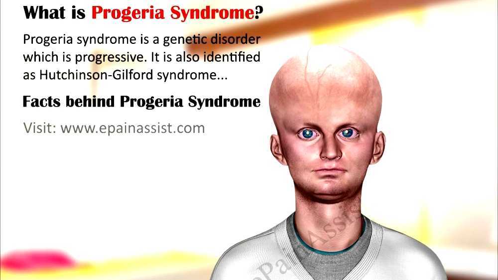 Progeria