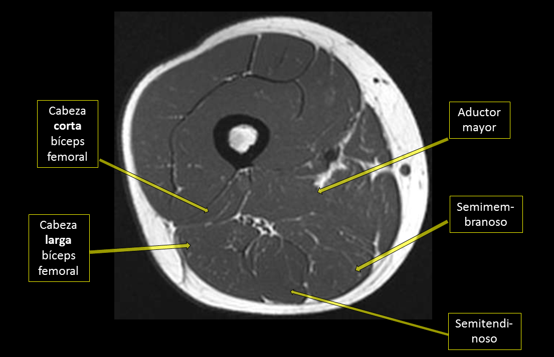 LABORATORIO DE IMÁGENES: Clase 7 - MUSLO