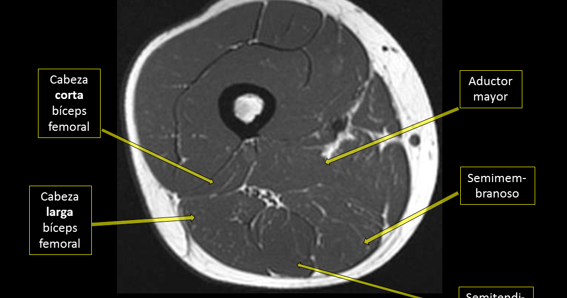 LABORATORIO DE IMÁGENES: Clase 7 - MUSLO
