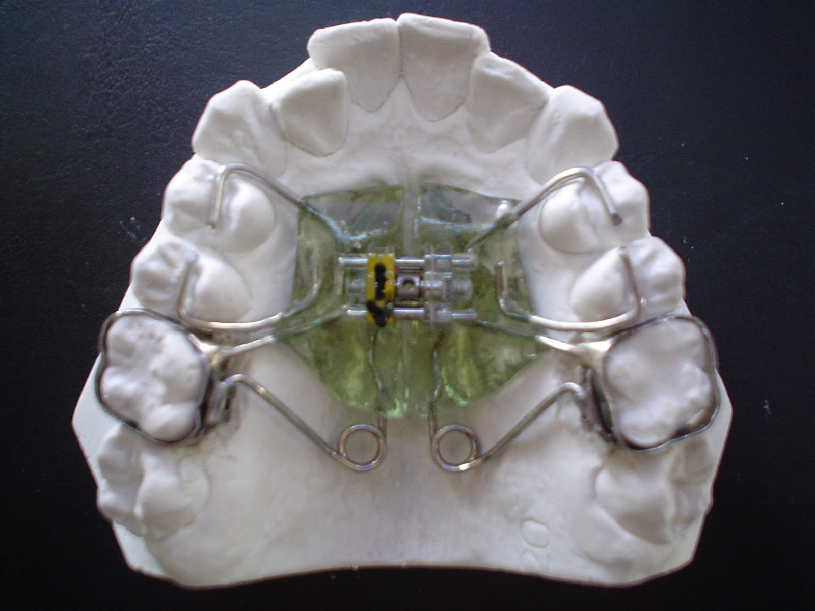 HM PRÓTESE ODONTOLÓGICA