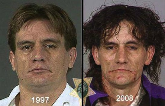 WHITE FOLK GONE WILD: SHOCKING CRYSTAL METH BEFORE AND AFTER PICTURES ...