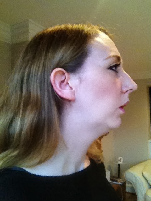 JawGodBlog: Before pics and intro