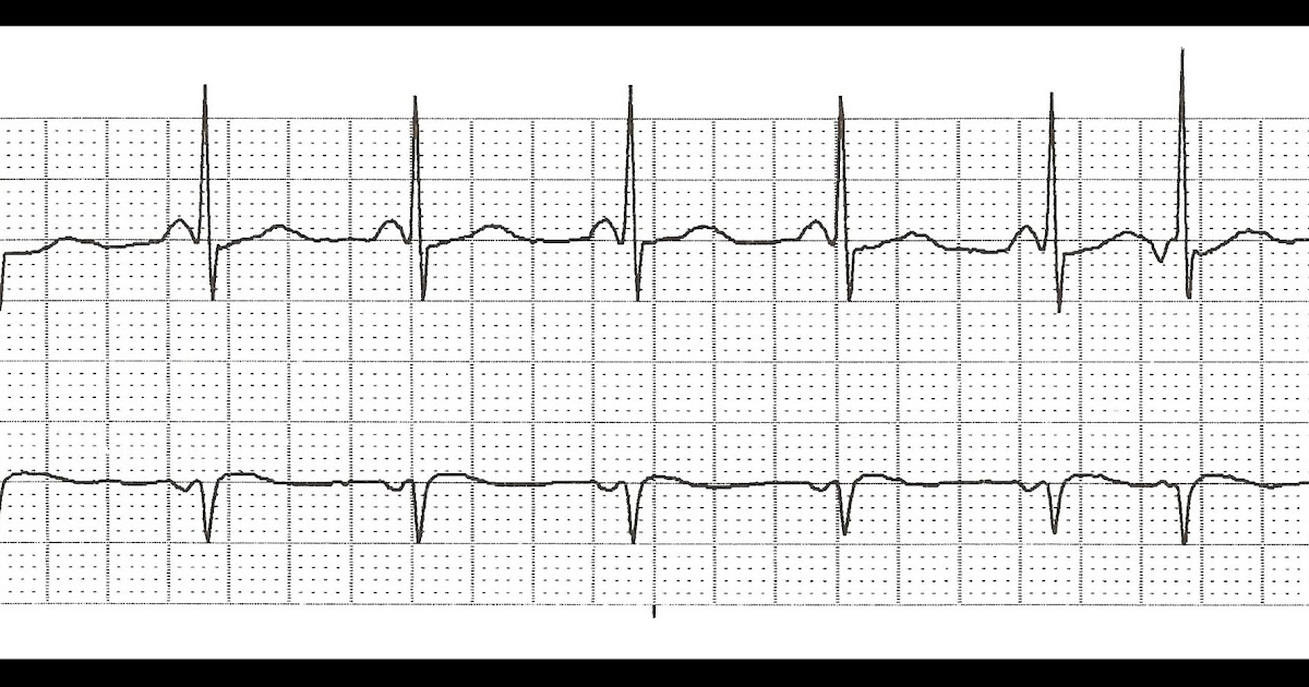 Basic Rhythm Test 27