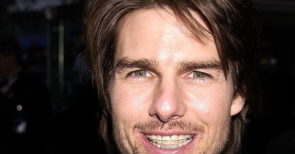 James R. Waters, DDS, MSD, PA: Braces are Better! (and here's why)