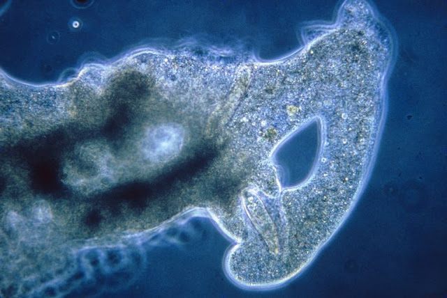 Amoeba