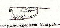 Inilah....!!!Teknik Operasi ROSER PLASTY. Silahkan Mencobanya ...