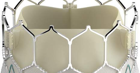 VÁLVULA ULTRA TRANSCATÉTER SAPIEN 3 DE EDWARDS PARA LA ESTENOSIS ...