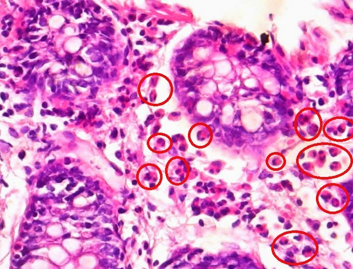 GASTROINTESTINAL AND LIVER HISTOLOGY PATHOLOGY ATLAS: August 2014