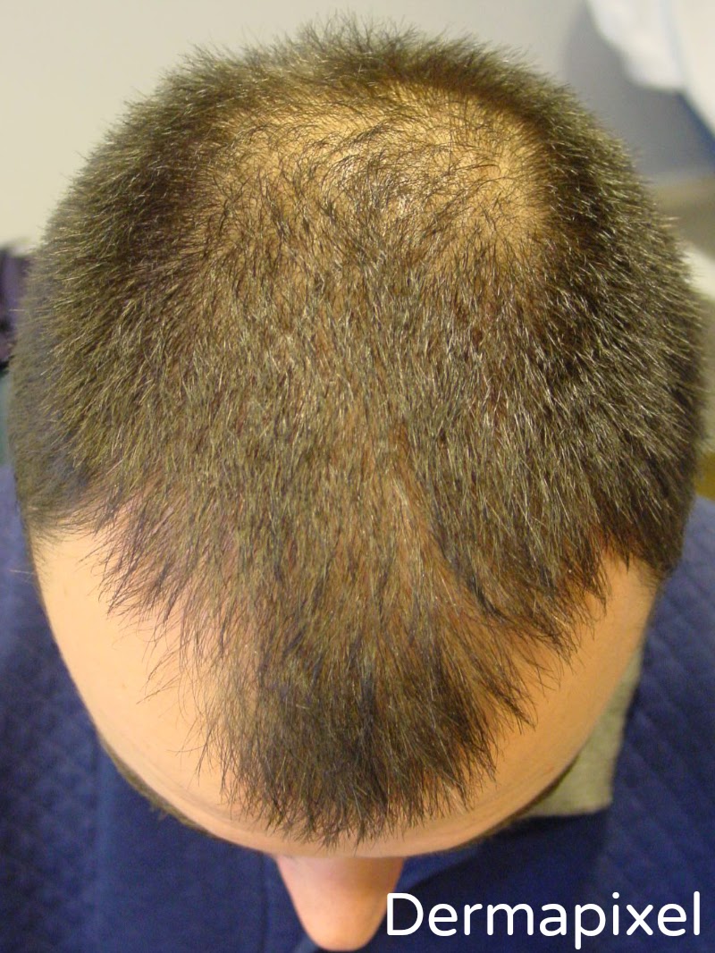 Dermapixel: julio 2017