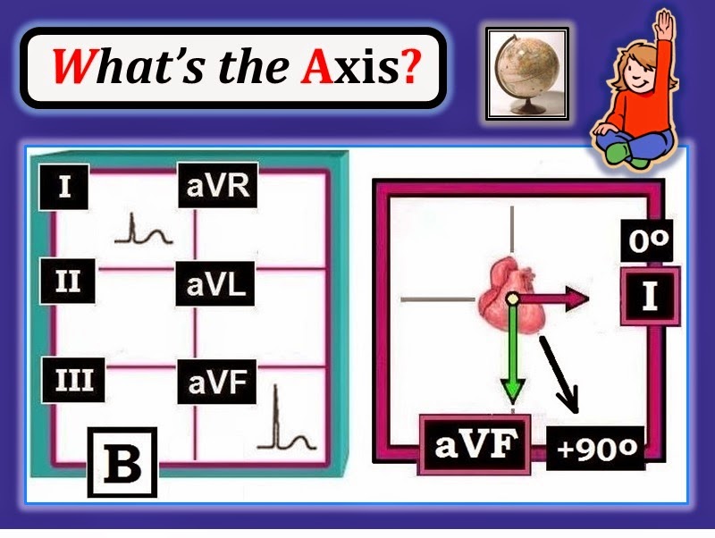 Normal ECG & electrocardiography principles (정상심전도) : 네이버 블로그