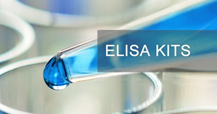 Elisa là gì- Giới thiệu kỹ thuật Elisa - Sinh Học Phân Tử