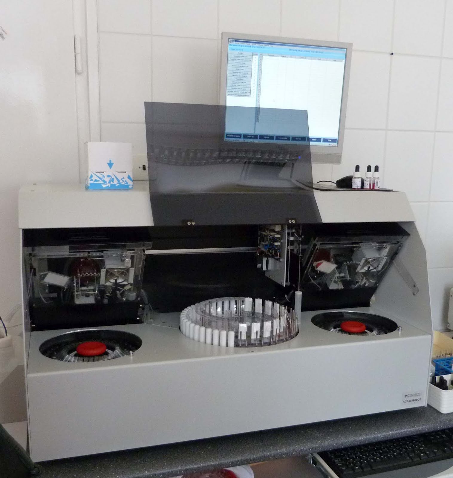 Lorne Labs UK: A Revolution in Blood Screening UK?