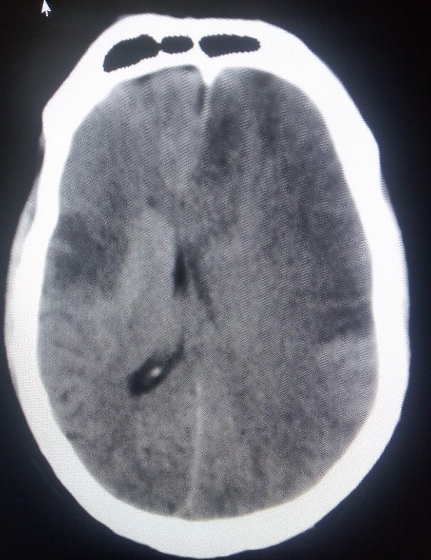 Snake Bite and Radiology - Sumer's Radiology Blog