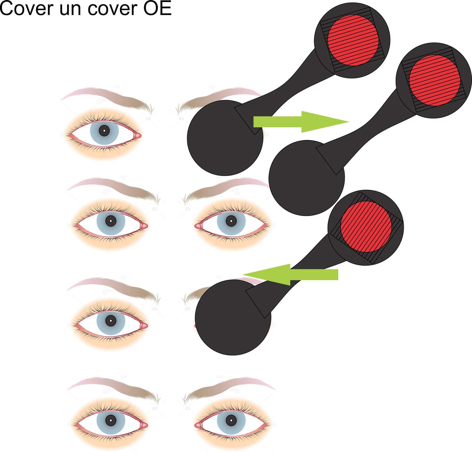 Optometria in Foco: Forometrias