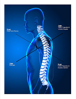 Dr. Bryon's Health Blog: Upper Crossed Syndrome
