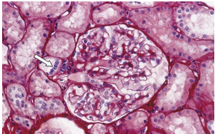 Histologi Ginjal - Scilintia