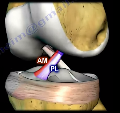Dr. Nabil Ebraheim's Blogspot: Pivot Shift of the Knee—ACL tear