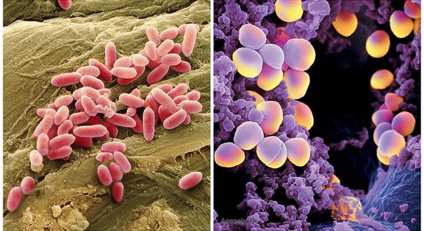 El Mundo De La CodificaciÓn ClÍnica Lista De Las 12 Superbacterias