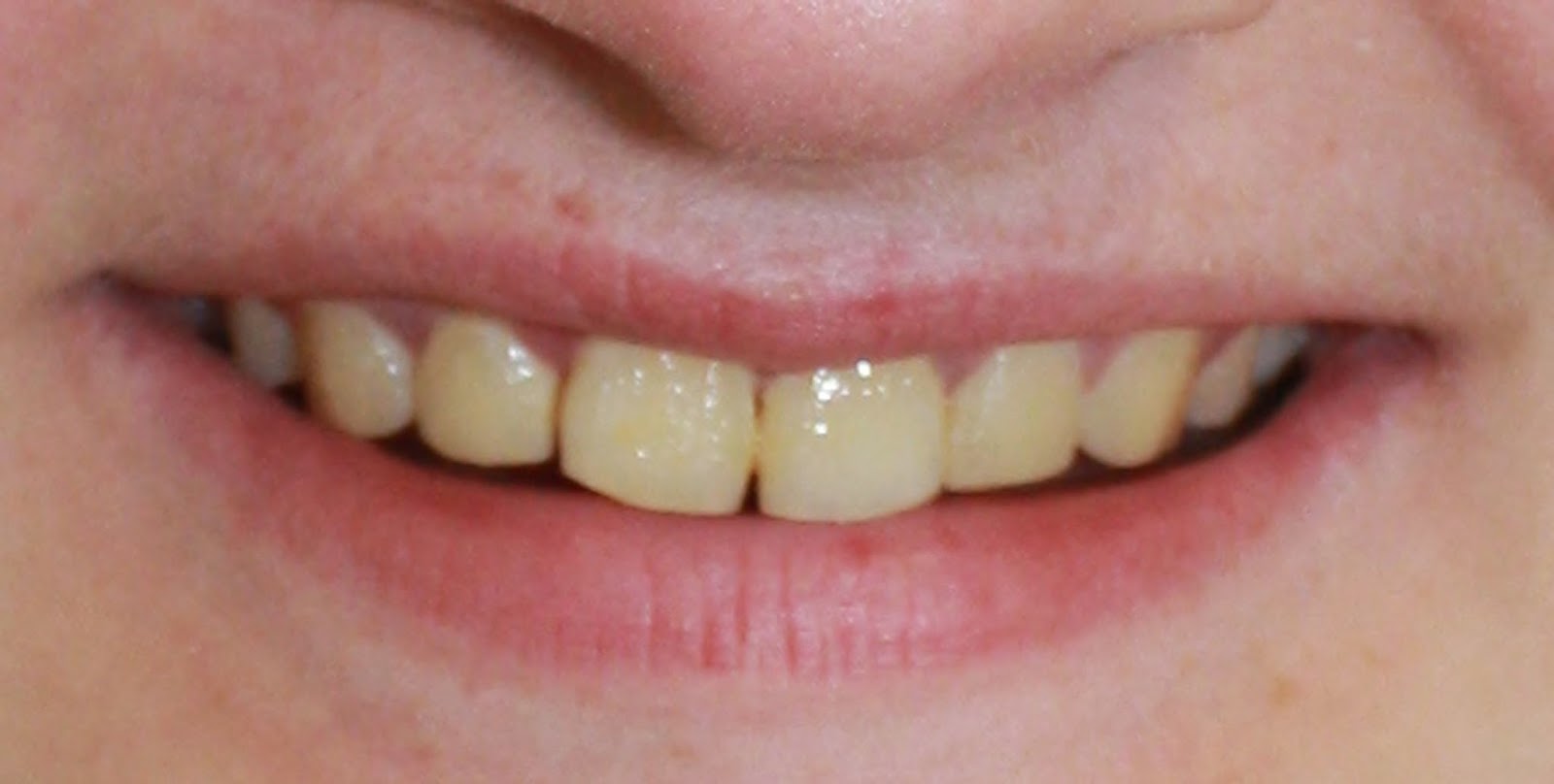 Unit 4 Photography: Edits