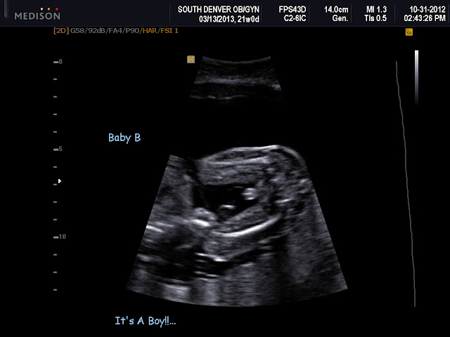A Road Well Traveled: Anatomy Scan- 21 weeks!