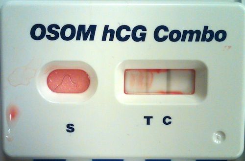 Trick Of The Trade Urine Pregnancy Test Without Urine Little White Coats trick-of-the-trade-urine-pregnancy-test-without-urine-little-white-coats