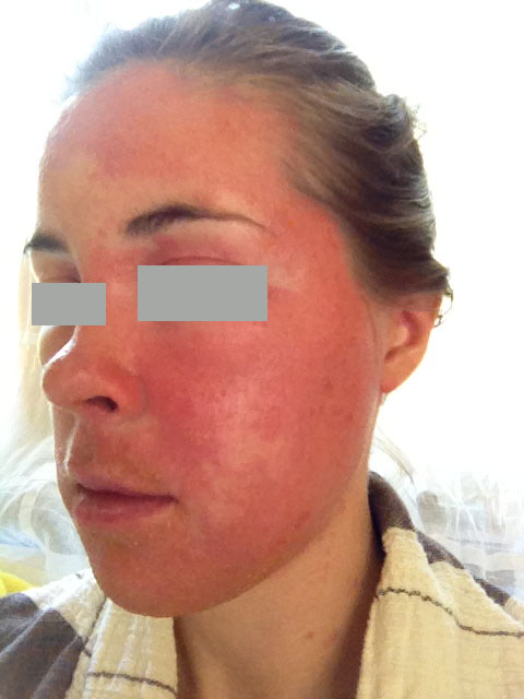 VIRTUAL GRAND ROUNDS IN DERMATOLOGY 2.0: Deadline Looming