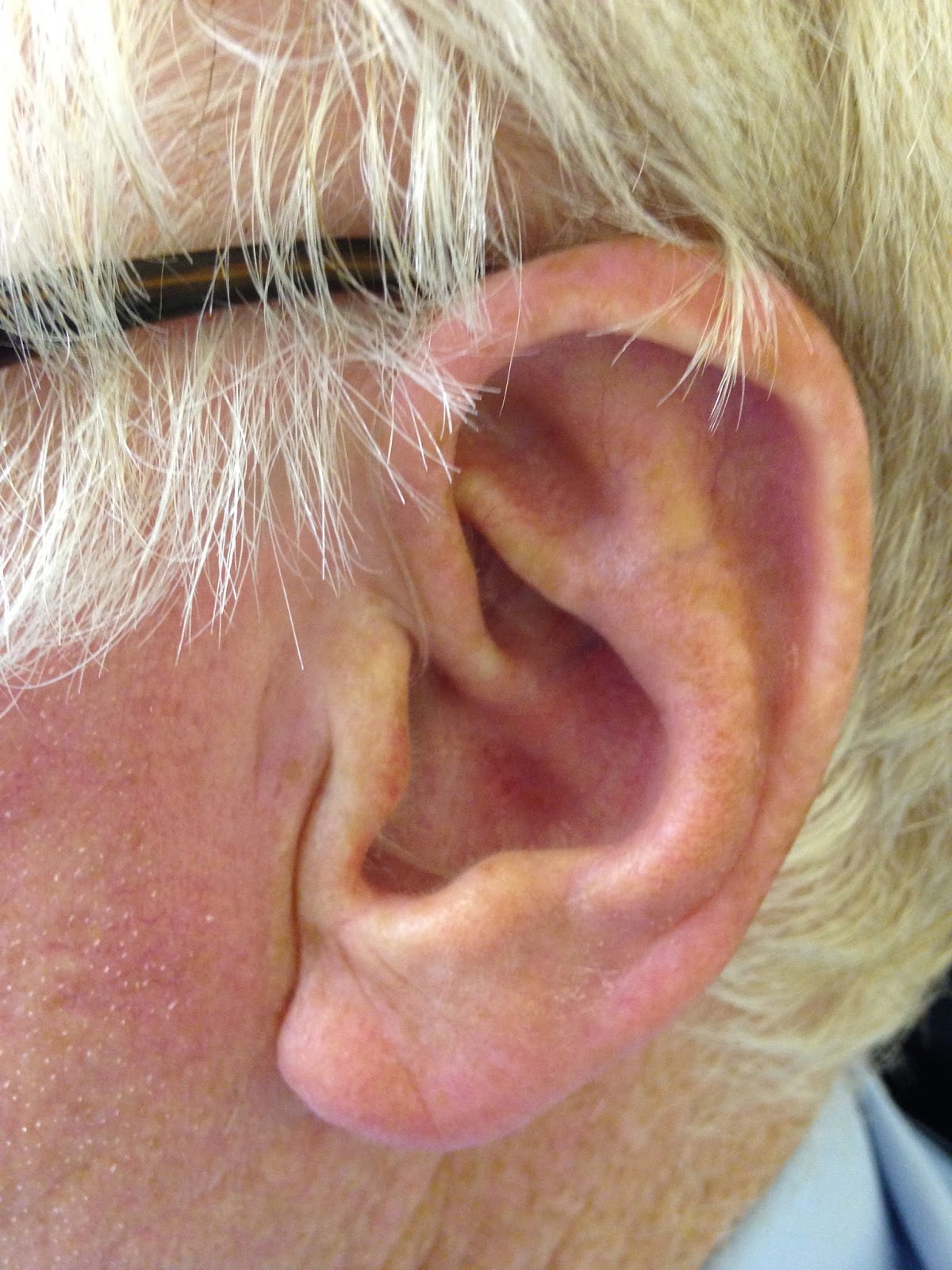 Wear your receiver in the ear hearing aid correctly (Good Advice from ...