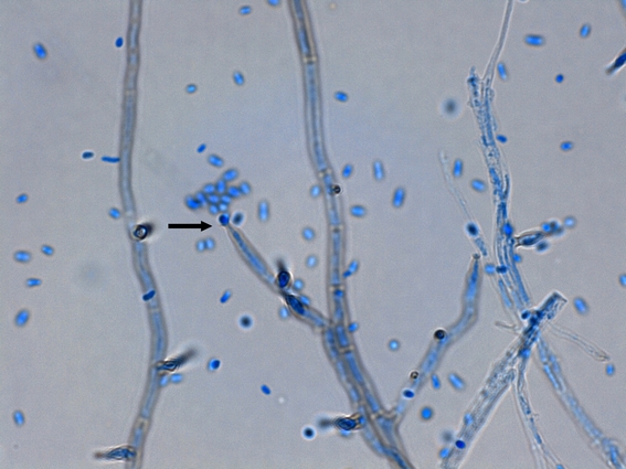 Fun With Microbiology (What's Buggin' You?): Pleruostomophora richardsiae