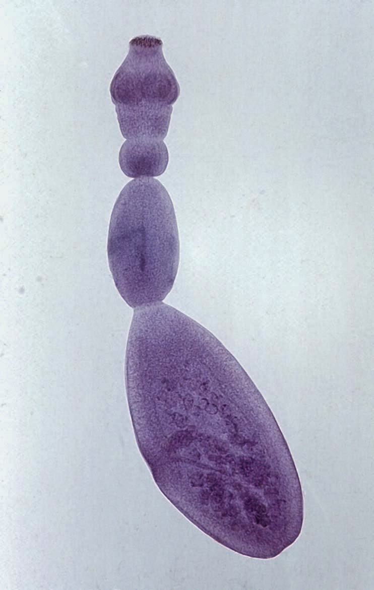 Tenia canina | Echinococcus granulasus un verme parassita che infetta ...
