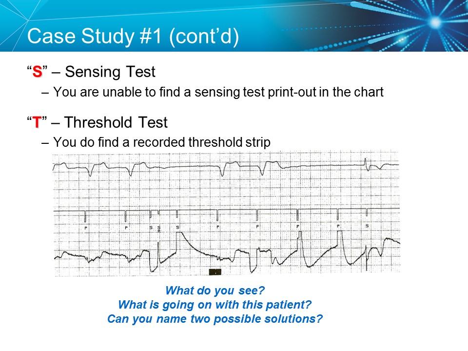 CVT Mohd Farid: Pacemaker Follow Up Part II-Medtronic Academy