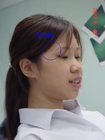 Dawn Yang before and after pictures and videos of her transformation ...