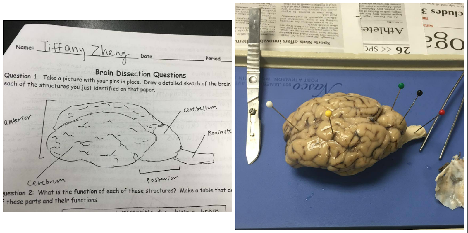 Anatomy And Physiology Brain Dissection Lab Report Anatomy And Physiology Brain Dissection Lab Report