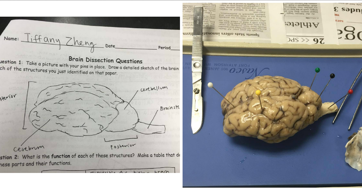 Anatomy and Physiology : Brain Dissection Lab Report